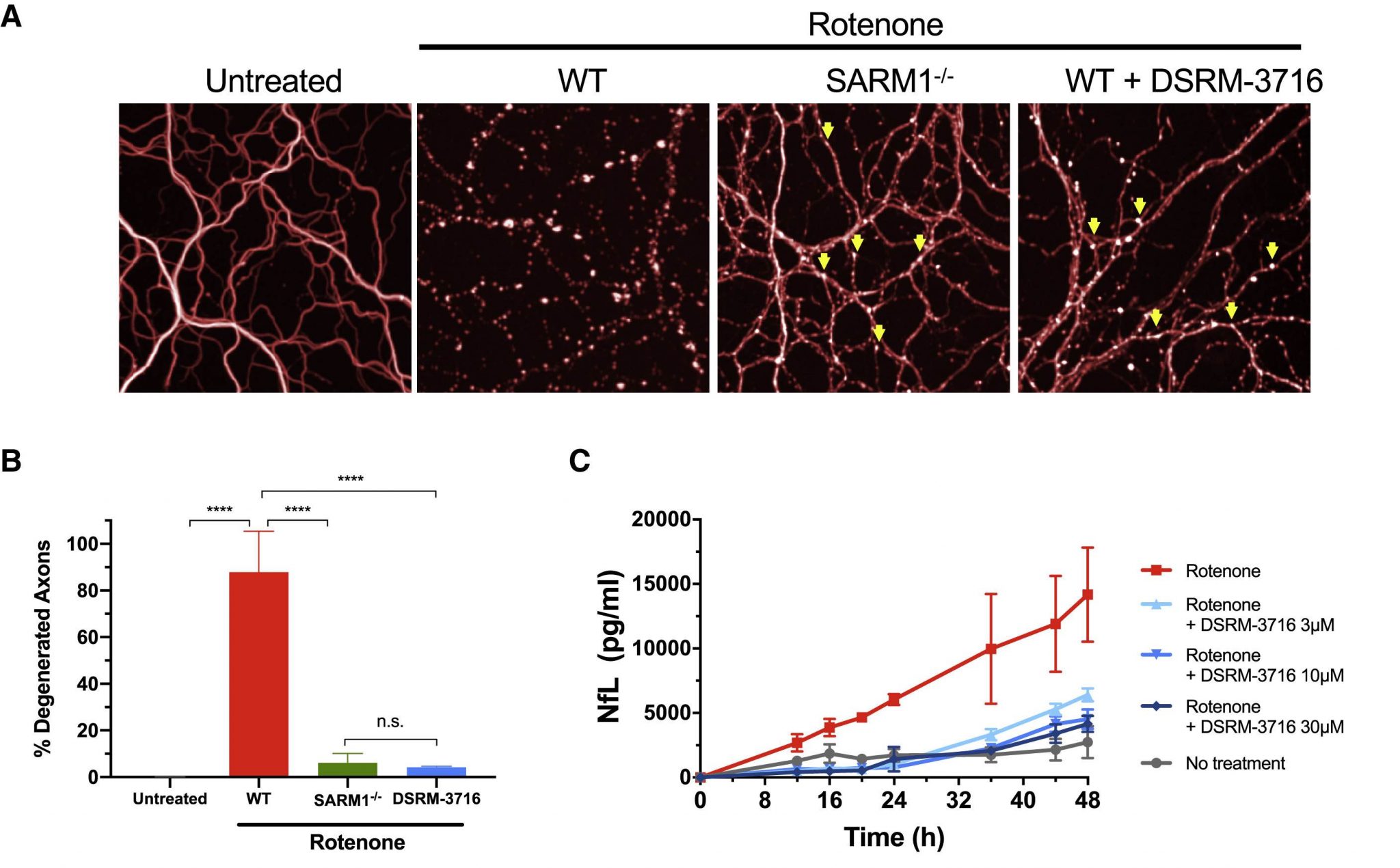 Eli Lilly & Company’s Small Molecule Prevents Neurodegeneration