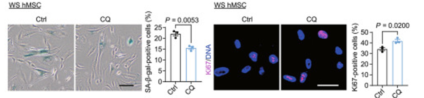 Study Shows Chloroquine Extends Lifespan and Rejuvenates Multiple Organs