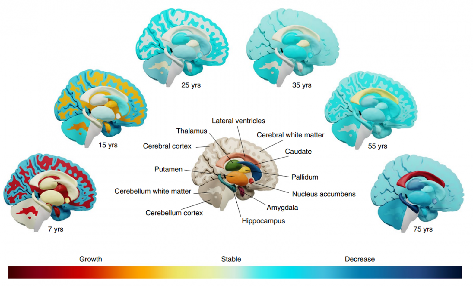 USC Researchers Identify Genes Associated with Structural Changes to ...